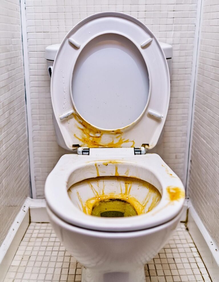 Got yellow stains on underside of toilet seat? Here's how to get rid of ...